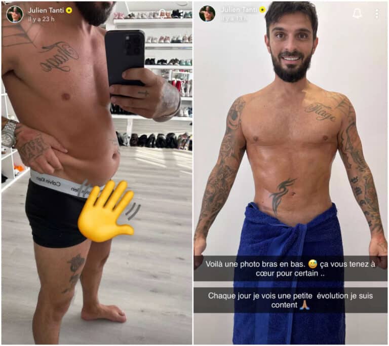 "Je vois une évolution" : Julien Tanti dévoile l'incroyable résultat de sa liposuccion | Newstories